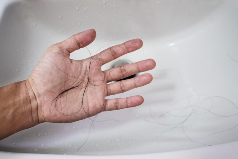5 Common Causes of Hair Loss in Shower and How to Prevent Them ...